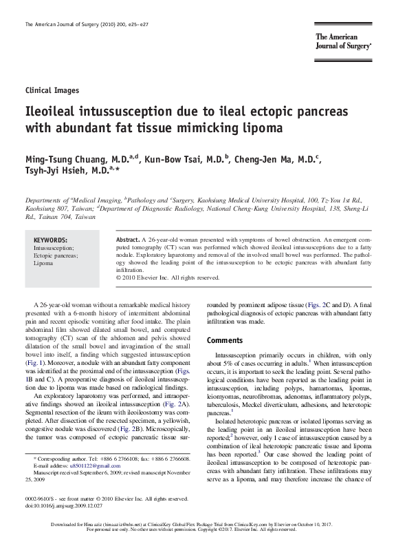 (PDF) Jejunal Intussusception Due to Heterotopic Pancreas: A Case Report | Vijay Naraynsingh ...