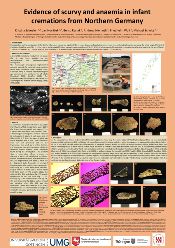 (PDF) Evidence of scurvy and anaemia in infant cremations from Northern ...