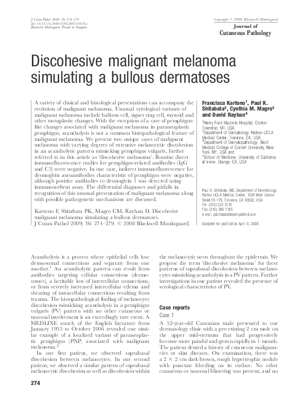(PDF) Discohesive malignant melanoma simulating a bullous dermatoses ...