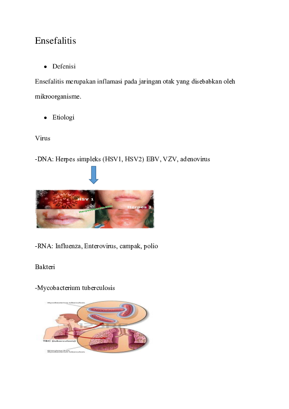 (DOC) Ensefalitis | Cut Nabila Amani - Academia.edu
