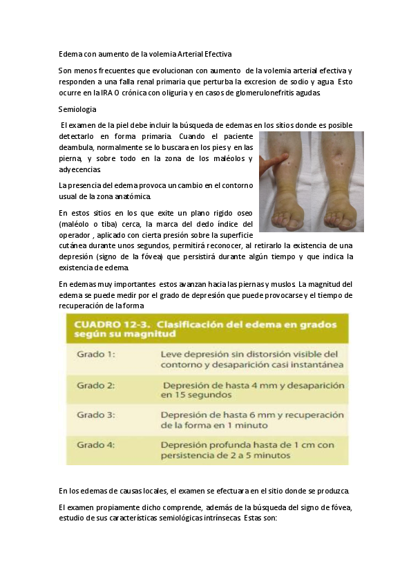(DOC) Edema con aumento de la volemia Arterial Efectiva