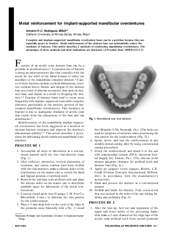 Pdf Metal Reinforcement For Implant Supported Mandibular Overdentures
