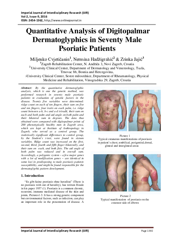 (PDF) Quantitative Analysis of Digitopalmar Dermatoglyphics in Seventy ...