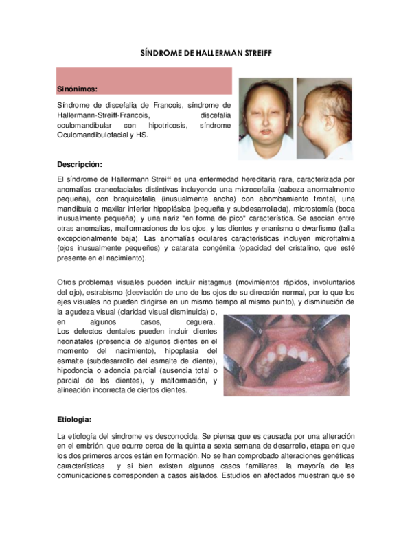 (DOC) SÍNDROME DE HALLERMAN STREIFF