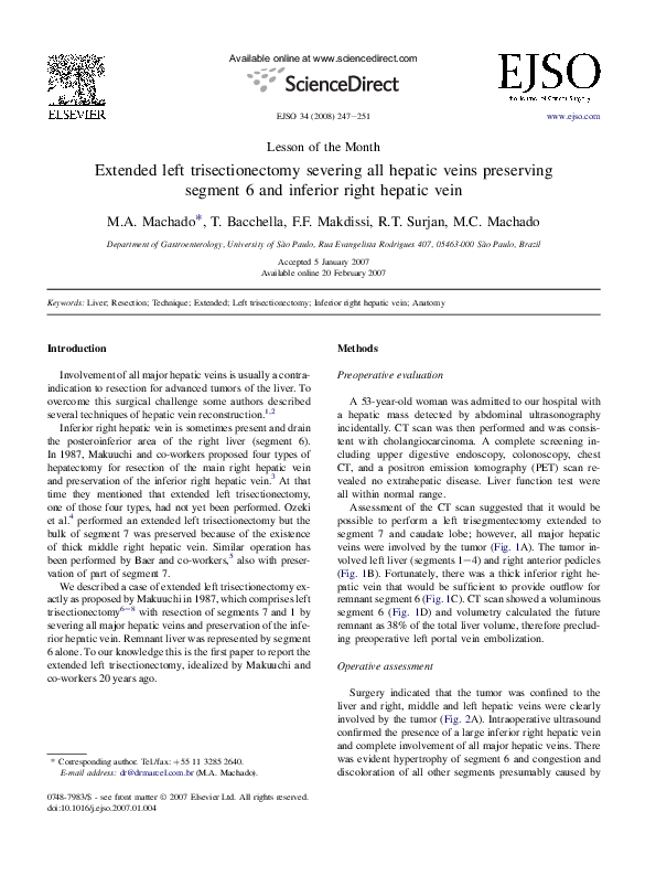 (PDF) Extended left trisectionectomy severing all hepatic veins ...
