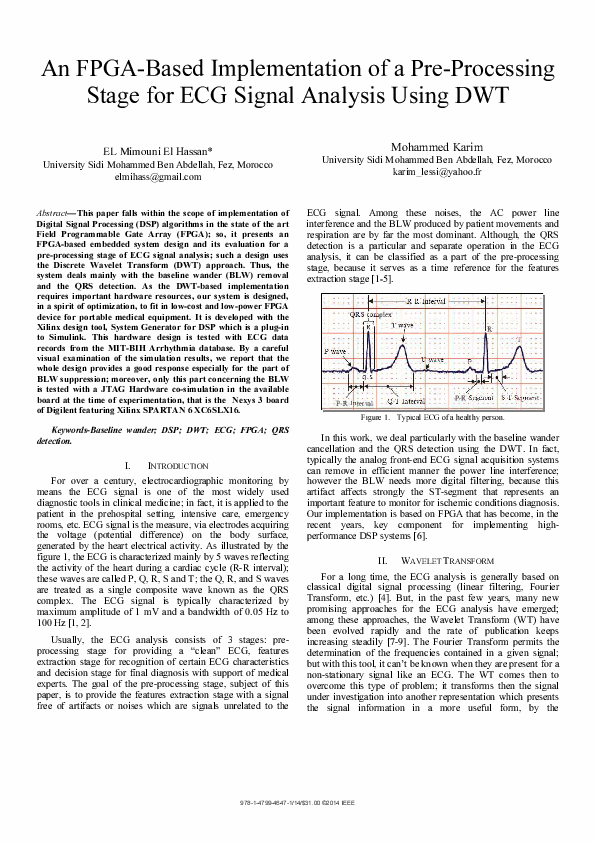 Pdf An Fpga Based Implementation Of A Pre Processing Stage For Ecg Signal Analysis Using Dwt