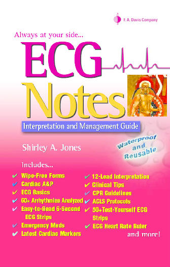 (PDF) ECG Notes Jones