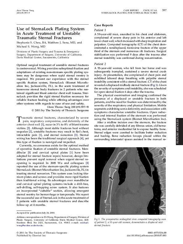 (PDF) Use of SternaLock Plating System in Acute Treatment of Unstable ...