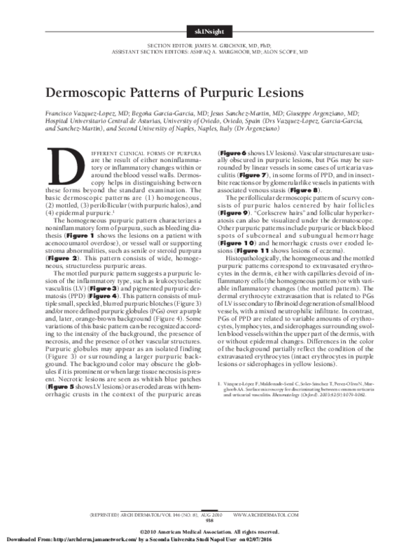 (PDF) Dermoscopic Patterns of Purpuric Lesions
