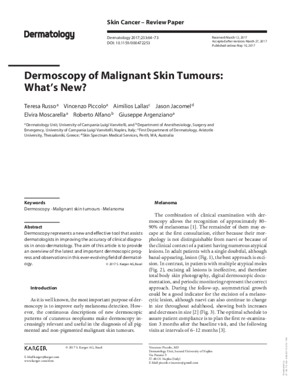 (PDF) Skin Cancer – Review Paper Dermoscopy of Malignant Skin Tumours ...