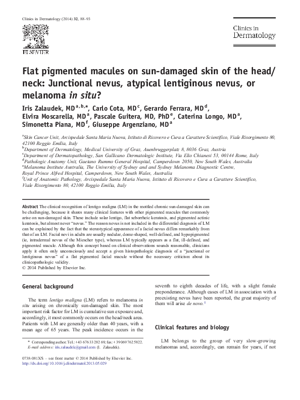 (PDF) Flat pigmented macules on sun-damaged skin of the head/ neck ...