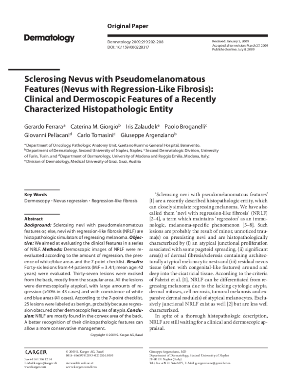 (PDF) Sclerosing Nevus with Pseudomelanomatous Features (Nevus with ...