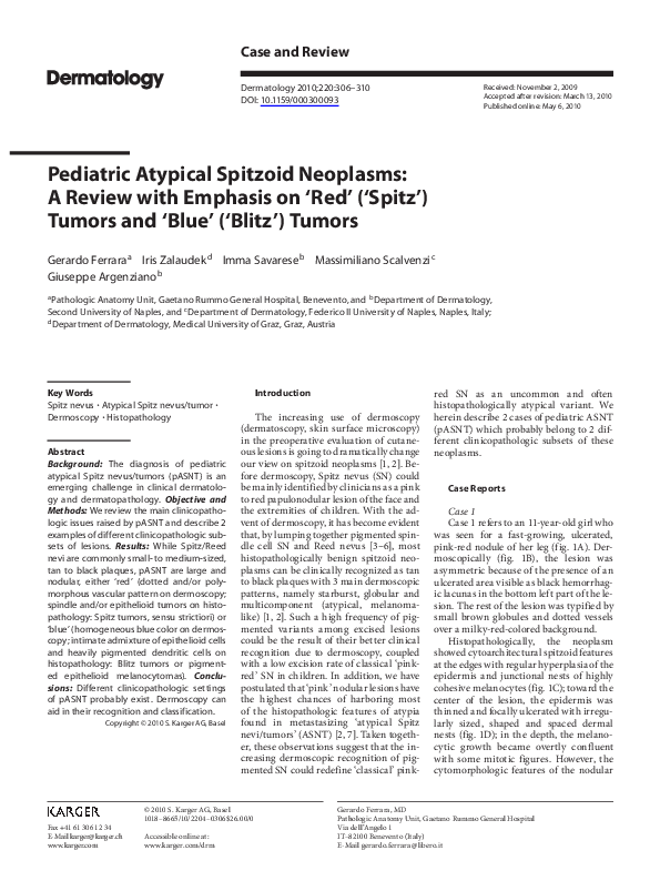 (PDF) Osteoma Cutis Arising in Common Blue Nevus (Blue Osteonevus): A ...