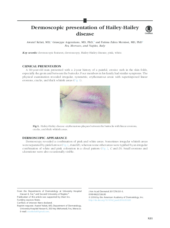 (PDF) Dermoscopic presentation of Hailey-Hailey disease
