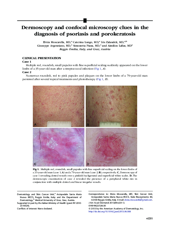 (PDF) Dermoscopy and confocal microscopy clues in the diagnosis of ...