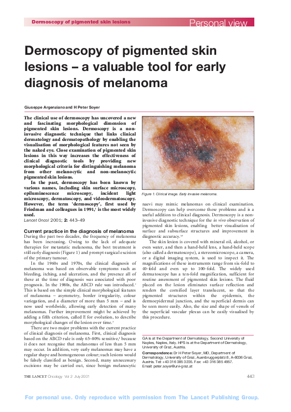 (PDF) Dermoscopy of pigmented skin lesions