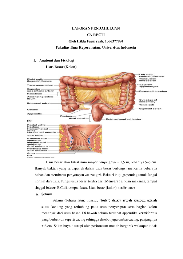 (DOC) LAPORAN PENDAHULUAN CA RECTI