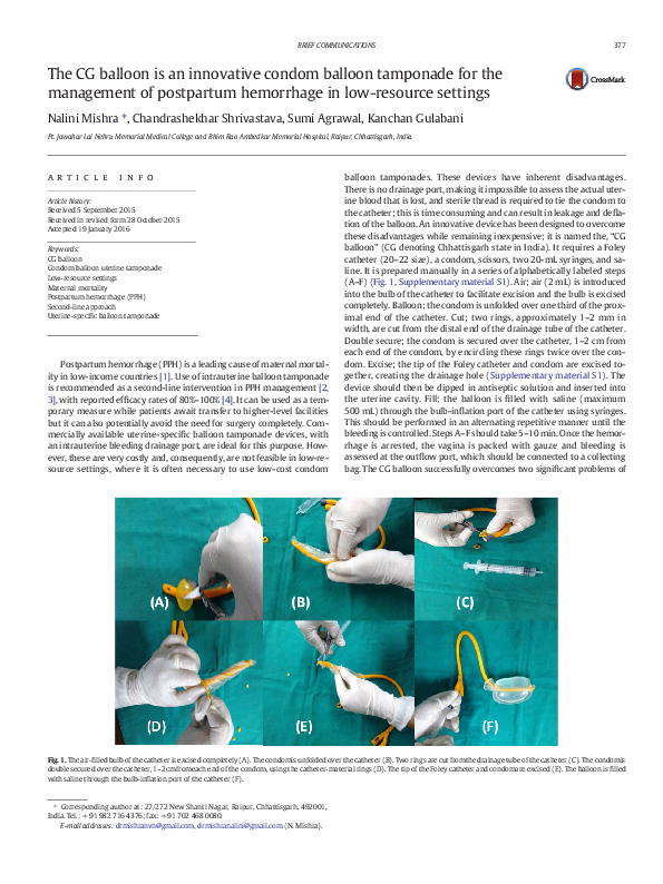 (PDF) The CG balloon is an innovative condom balloon tamponade for the ...