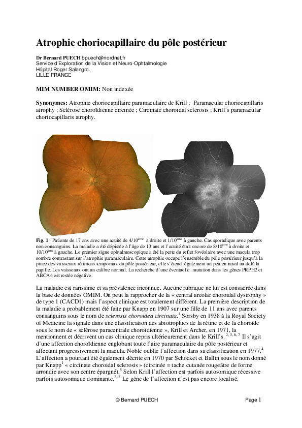 (PDF) PARAMACULAR CHORIOCAPILLARIS ATROPHY (Atrophie choriocapillaire ...