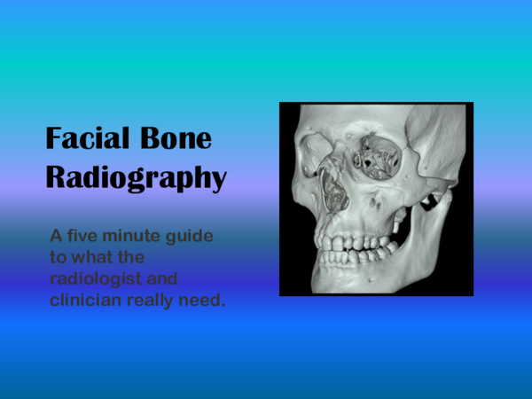 (PPT) Facial Bones Power Point.pptx
