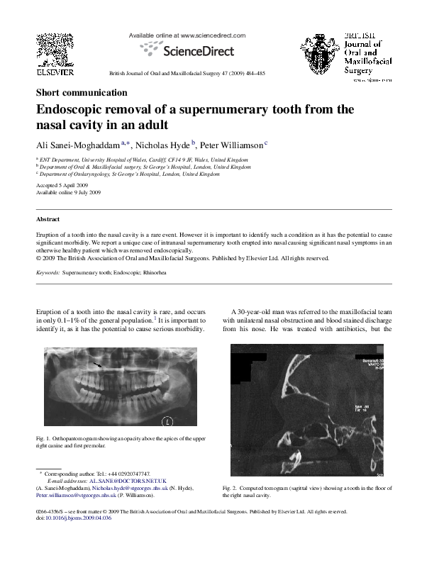 (PDF) Endoscopic removal of a supernumerary tooth from the nasal cavity ...