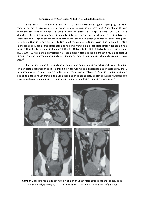 (DOC) Pemeriksaan CT Scan untuk Nefrolithiasis dan Hidronefrosis