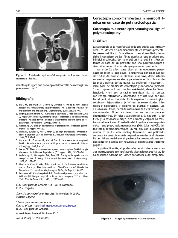 (PDF) Corectopia como manifestación neurooftálmica en un caso de ...