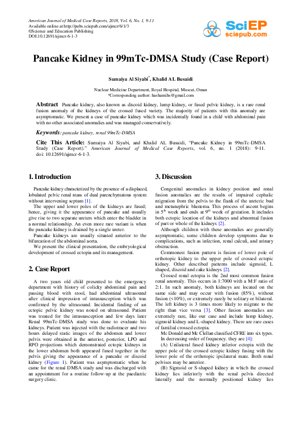 (PDF) Pancake Kidney in 99mTc-DMSA Study (Case Report