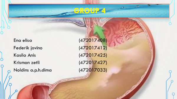 (PPT) GROUP 4 GERD