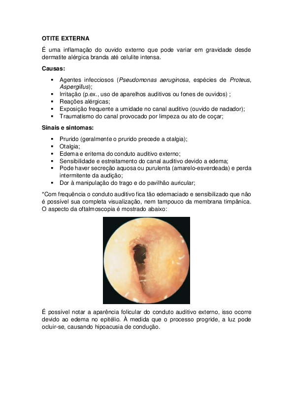 (DOC) OTITE EXTERNA
