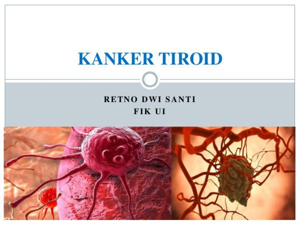 (PPT) PPT PRESENTASI KANKER TIROID