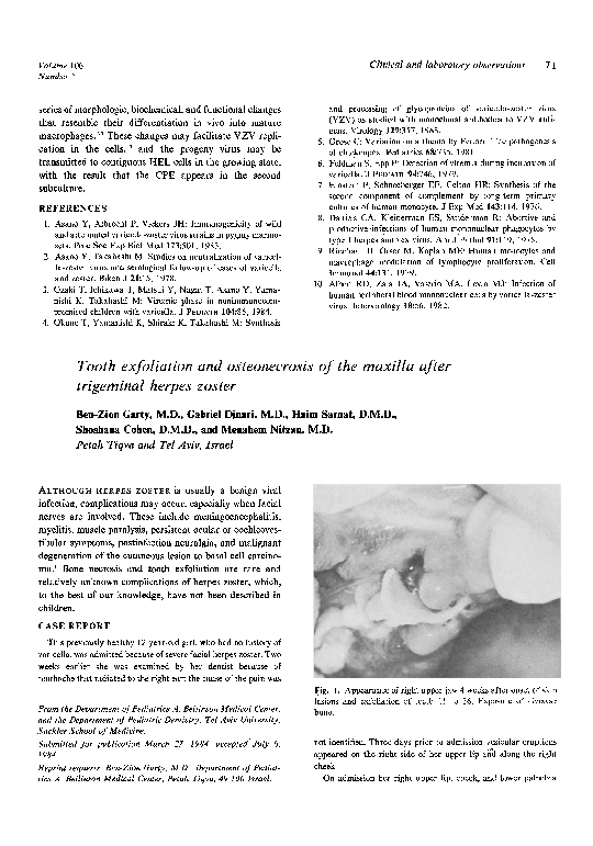 (PDF) Tooth exfoliation and osteonecrosis of the maxilla after ...