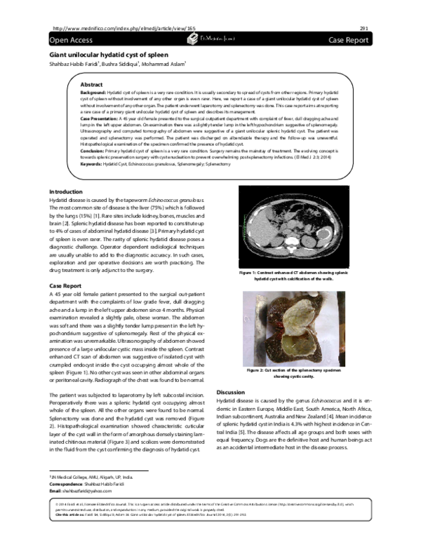 Pdf Giant Unilocular Hydatid Cyst Of Spleen Mohammad Aslam