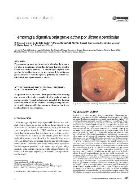 (PDF) Hemorragia digestiva baja grave activa por úlcera apendicular