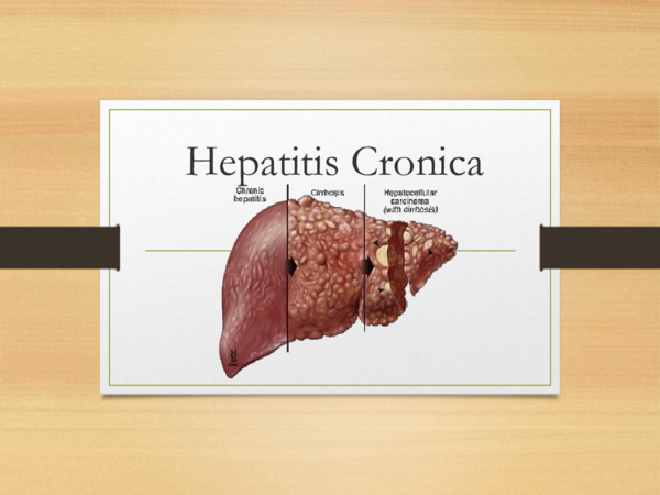 (PPT) Hepatitis Cronica