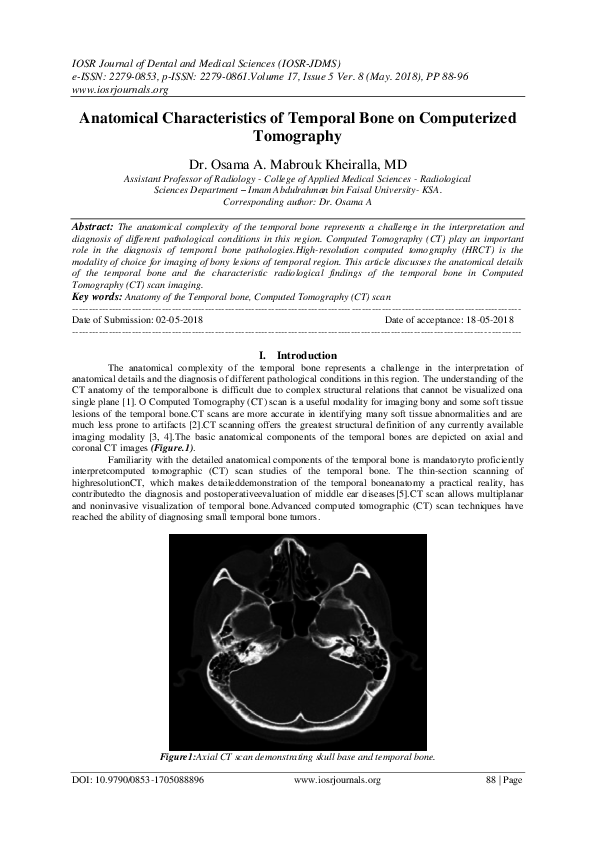 (PDF) Anatomical Characteristics of Temporal Bone on Computerized ...