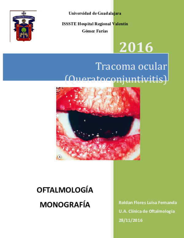 (DOC) Tracoma