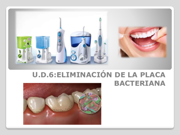 (PPT) U.D.1 ELIMINACION DE LA PLACA BACTERIANA