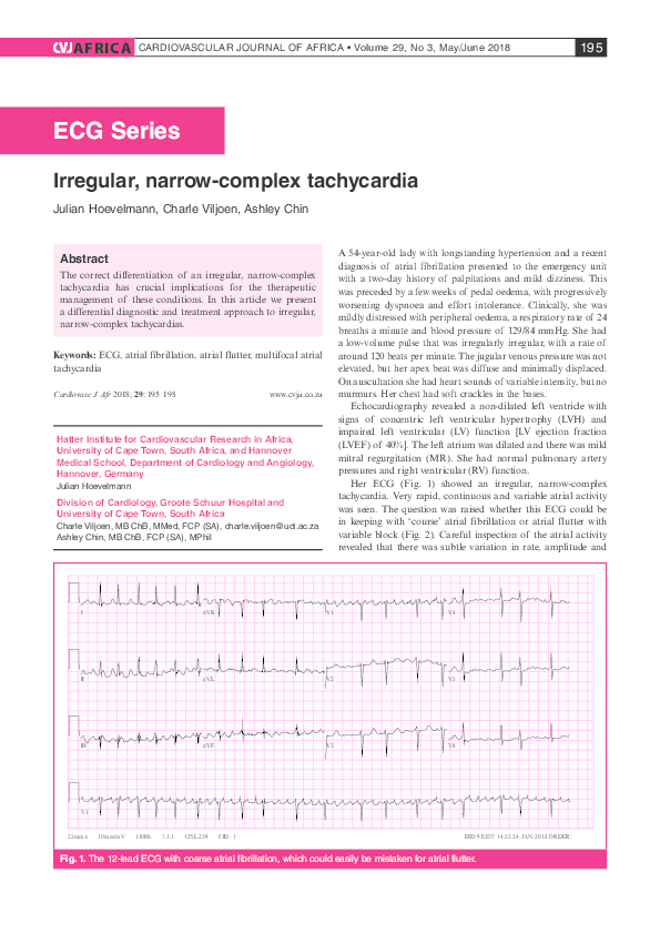 (PDF) Irregular, narrow-complex tachycardia | Charle Viljoen and Julian ...