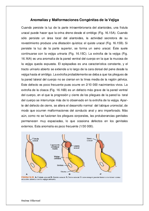 (DOC) Anomalías y Malformaciones Congénitas de la Vejiga
