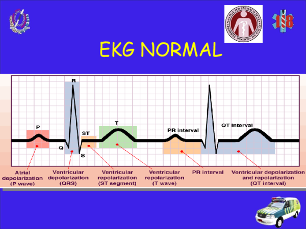(PPT) EKG Normal
