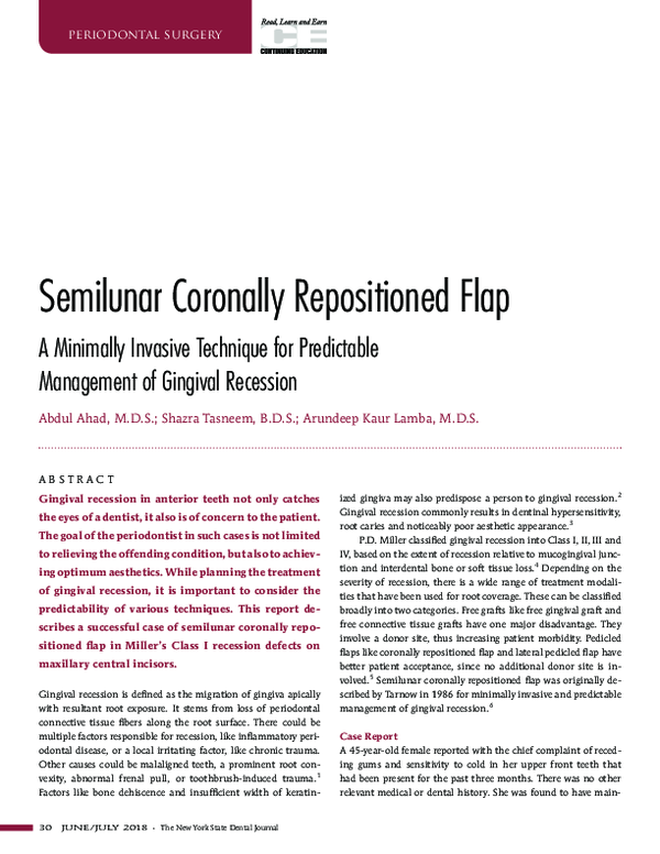 (PDF) Semilunar Coronally Repositioned Flap A Minimally Invasive ...
