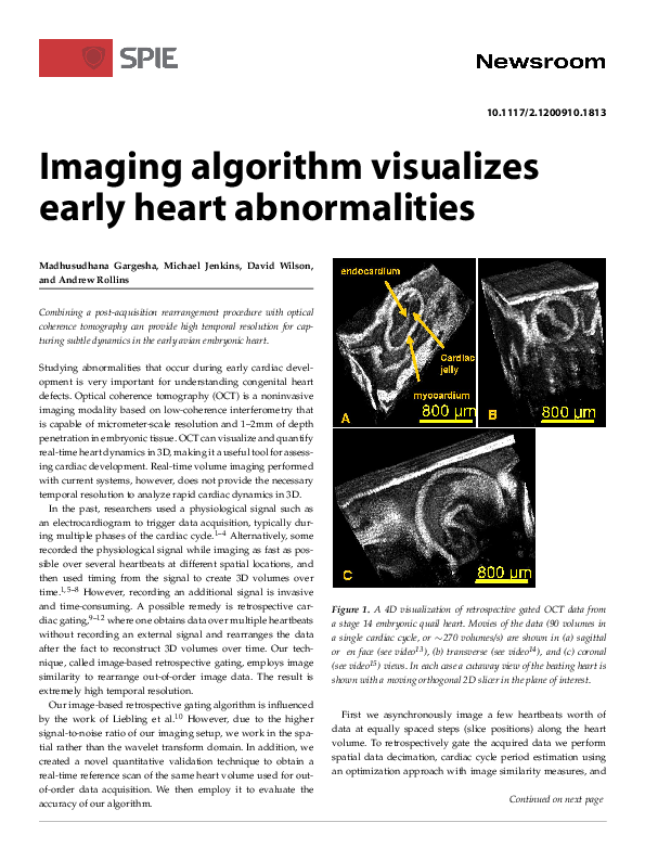 (PDF) Imaging algorithm visualizes early heart abnormalities