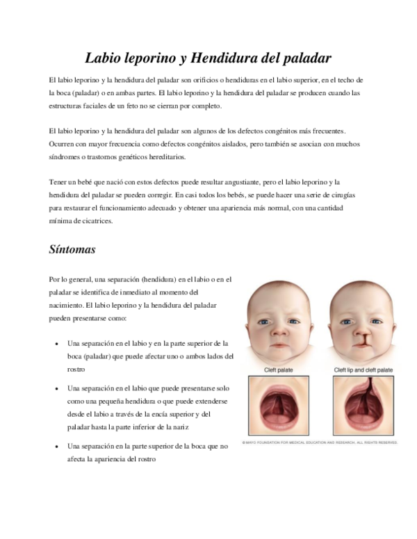 (DOC) Labio leporino y Hendidura del paladar