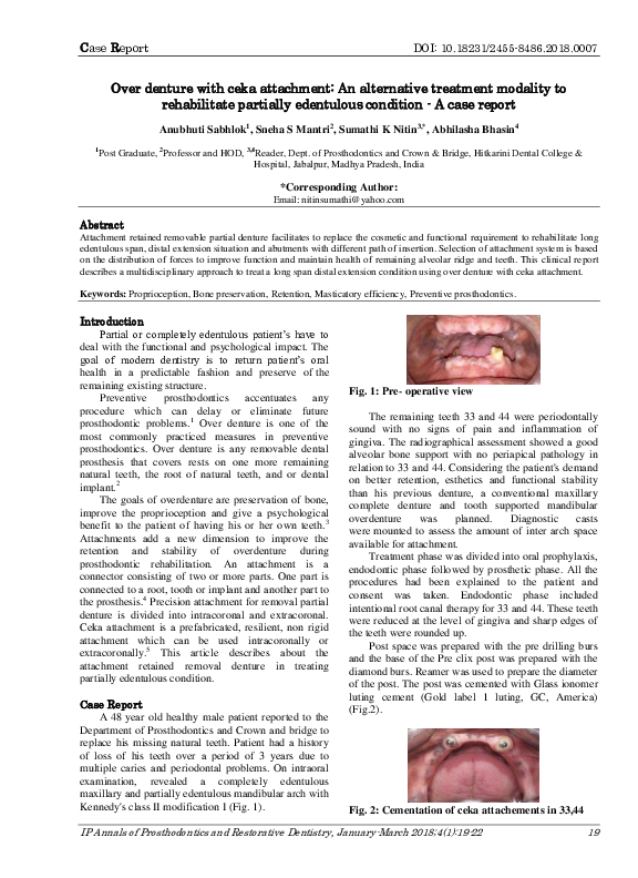 (PDF) Over denture with ceka attachment: An alternative treatment ...