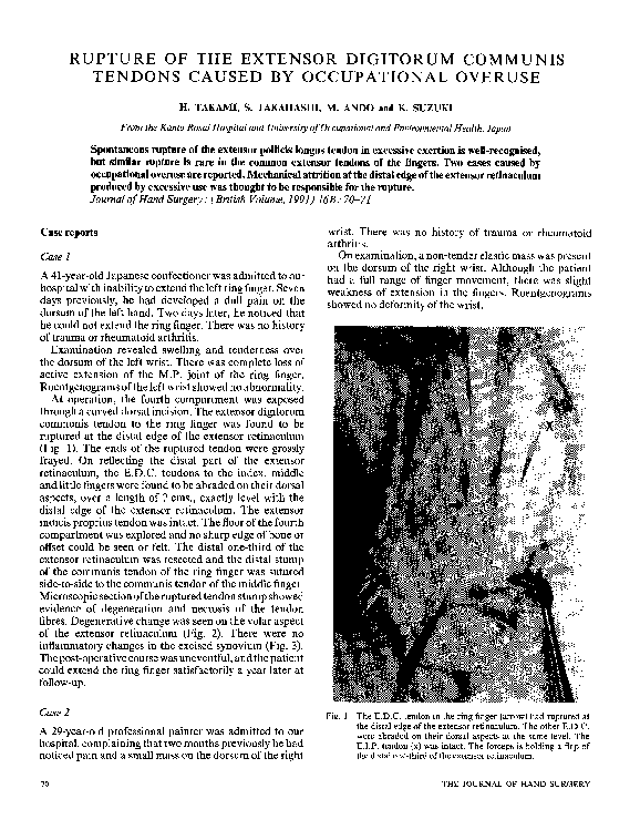 (PDF) Rupture of the extensor digitorum communis tendons caused by ...
