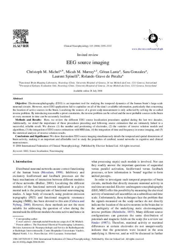 (PDF) EEG source imaging