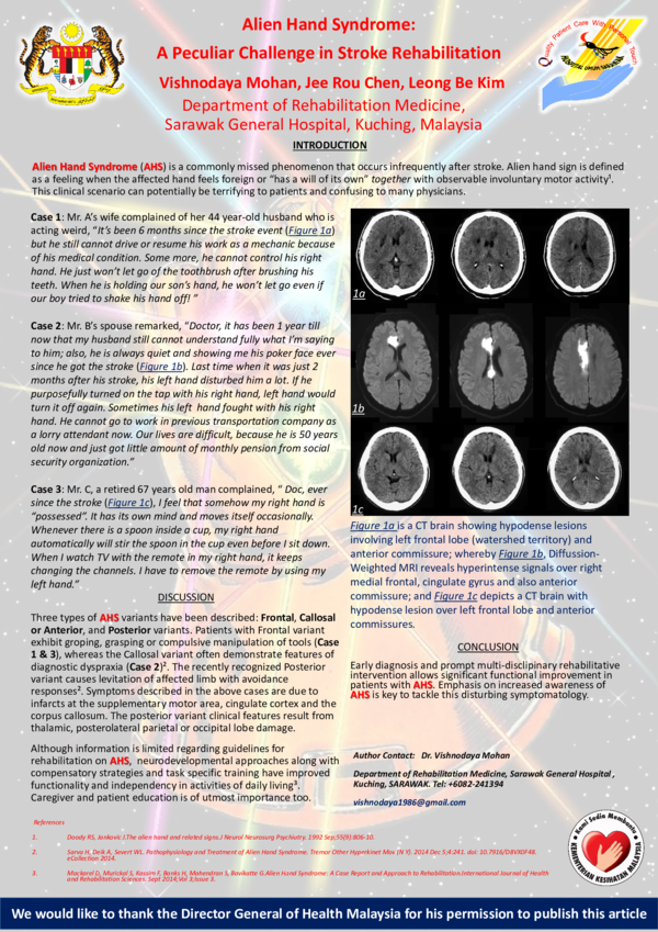 (PDF) Alien Hand Syndrome: A Peculiar Challenge in Stroke ...