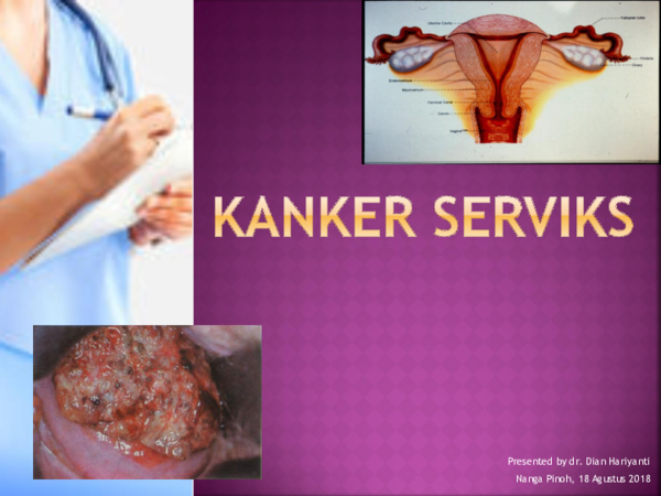 (PPT) Ca serviks presentation