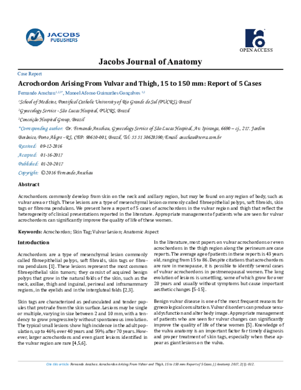 (PDF) Acrochordon Arising From Vulvar and Thigh, 15 to 150 mm: Report ...